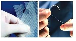 Application of Medical Textiles | Implantable Medical Textiles ...