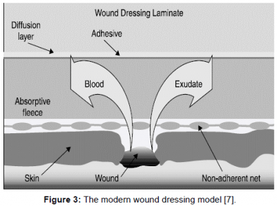 Application of Medical Textiles | Non-Implantable Medical Textiles ...